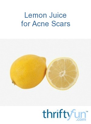 Lemon Juice for Acne Scars | ThriftyFun