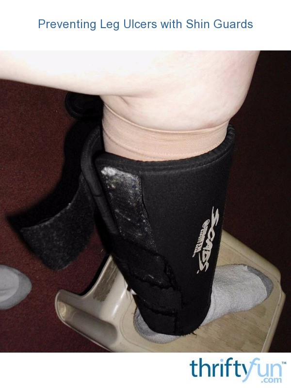 Preventing Leg Ulcers with Shin Guards | ThriftyFun