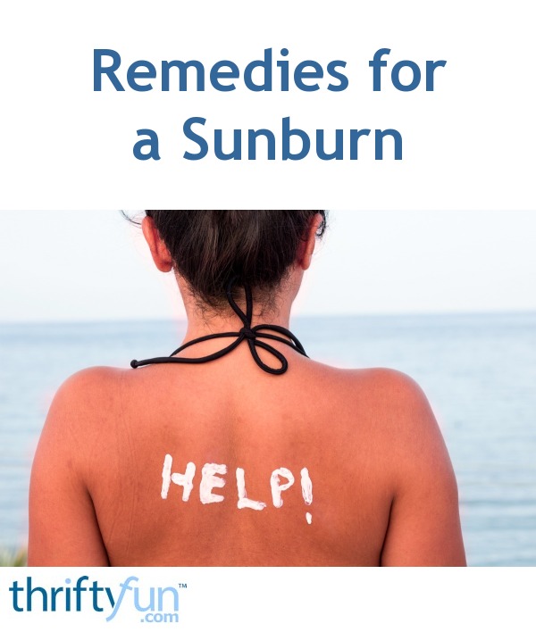 Remedies For A Sunburn Thriftyfun