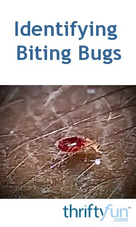 Identifying Biting Bugs? | ThriftyFun